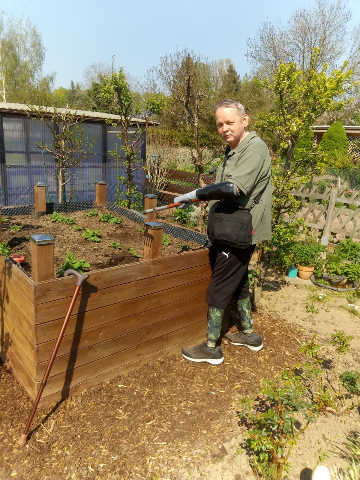 Lerne deine Prothese kennen! – handicap.life